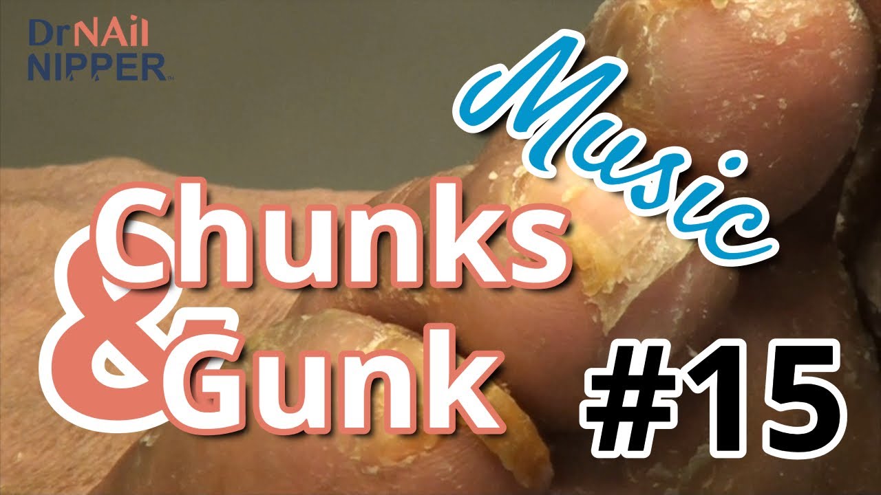 Chunk and Gunk #15 - Dr Nail Nipper music (2022) - Dr Nail Nipper