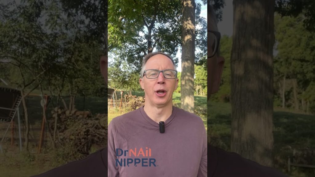 Thick Toenails, Exercise, Healthy Lifestyle - John from Outdoor Kitchen Pro - Dr Nail Nipper